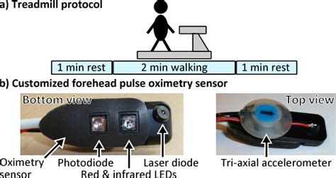 Figure 1 From Reduction Of Periodic Motion Artifacts In Photoplethysmography Semantic Scholar