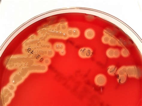 Gallibacterium Anatis After 48h Encyclopedia Mdpi