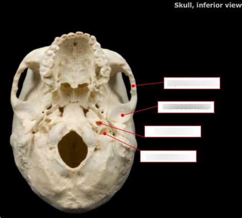 Temporal Bone Parts 2 Diagram Quizlet