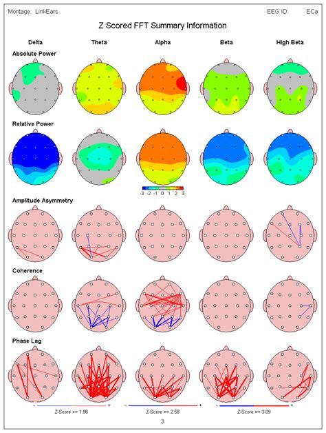 Eeg Brain Wave Test Digital