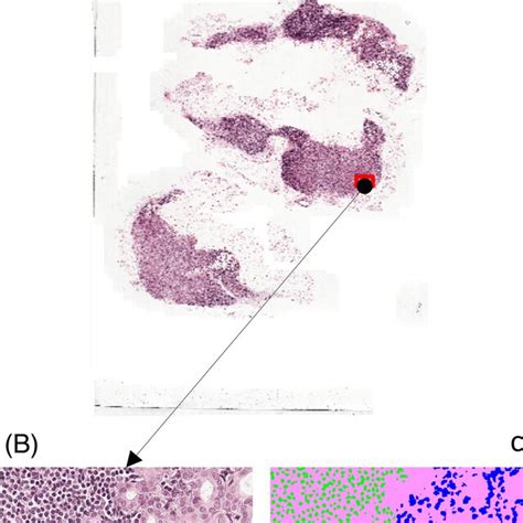 Proposed Approach A Wsi B A Patch Of Wsi C Semantic Download Scientific Diagram
