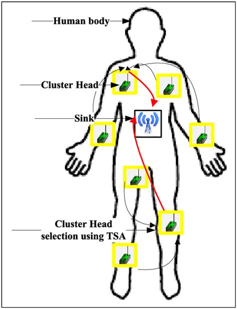 Intelligent‐routing Algorithm For Wireless Body Area Networks I‐raw