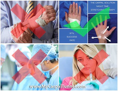 What To Do Carpal Tunnel Symptoms Return After Surgery