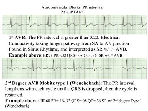Algorithm For Rhythm Interpretation1
