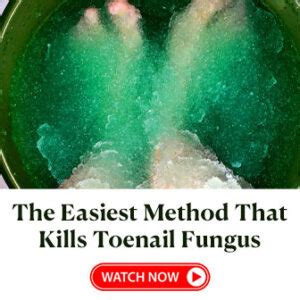 White Vinegar For Toenail Fungus Does It Really Work