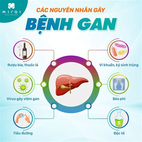 Top NguyÊn NhÂn GÂy BỆnh Gan