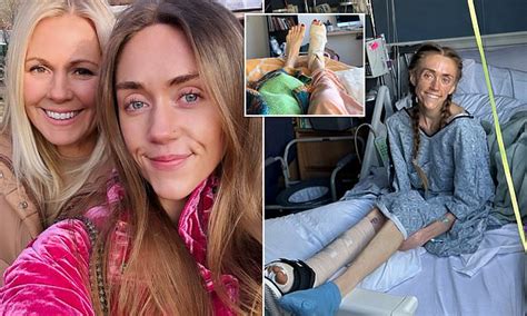 Sepsis Causes Signs Symptoms And Treatment Daily Mail Online