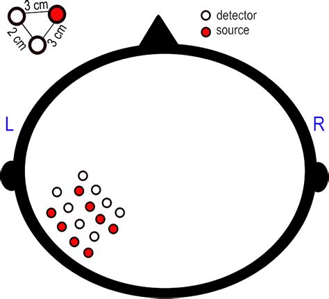 Figure 3 From Anatomical Atlas Guided Diffuse Optical Tomography Of
