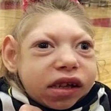 Retard Girl Know Your Meme