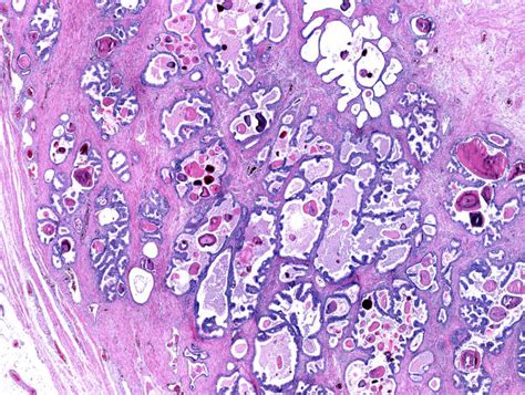 Colorazione Ematossilina Eosina Foto E Immagini Stock Istock