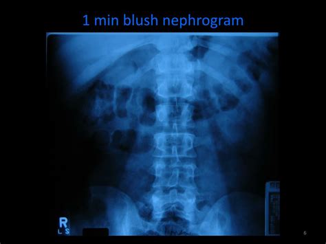Ppt Lab Positioning For Gu System Ivp And Cysto And Ercp Powerpoint