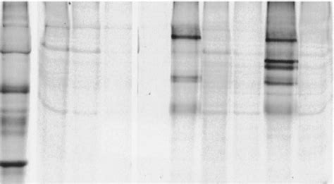 Radioimmunoprecipitation Of Bvdv Infected Calf Testis Cells With