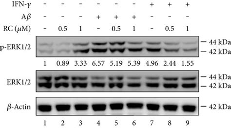 rc abrogates aβ and ifn γ induced nf κb and erk activation bv 2 cells