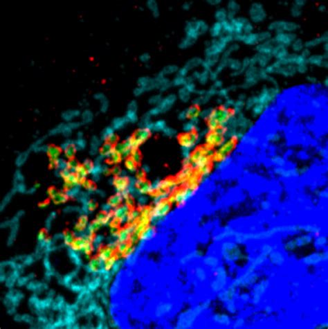 Super Resolution Microscopy Archives Focalplane