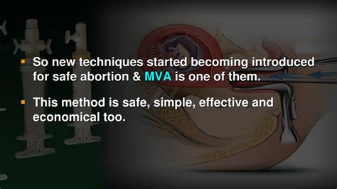 PPT MVA PowerPoint Presentation Free Download ID 4524422