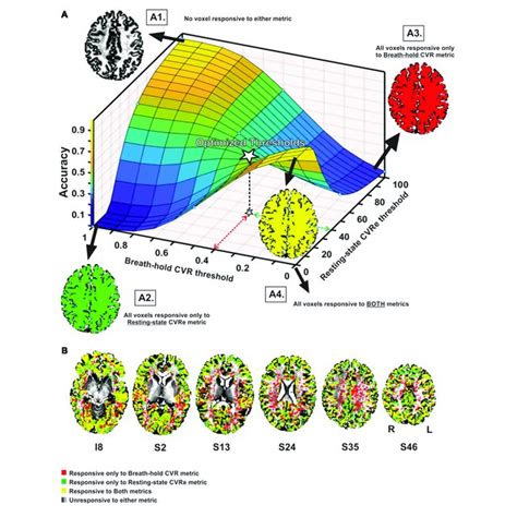 Voxel Wise Correspondence Of Resting State Cvre And Gray Matter Download Scientific Diagram
