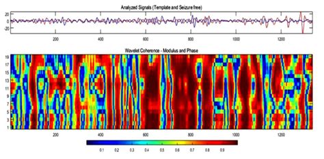 Wavelet Coherence For A Template And A Seizure Free Window Download Scientific Diagram