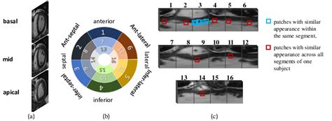 Myocardium Segment Re Sampling The 16 Segments Obtained From Short