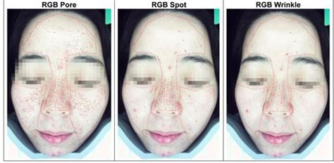 Skin Analyser Tranquil Essence