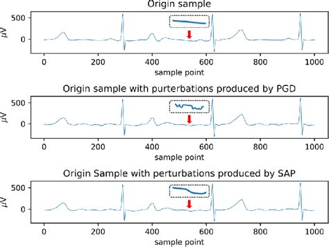 Figure 1 From Defending Against Adversarial Attack In Ecg Classification With Adversarial