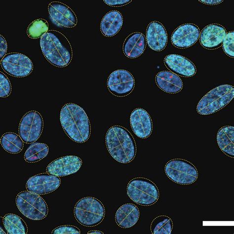 Foci Detection Of Dna Double Strand Breaks Dsbs And Cell Nuclei By Download Scientific