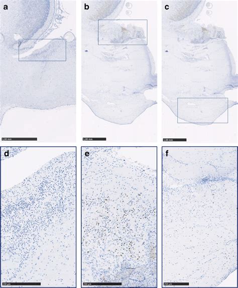 NeuN Staining Bc And Magnification Images Ef Of Case Download Scientific Diagram