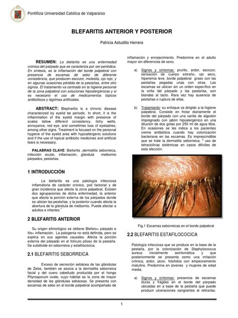 Blefaritis Anterior Y Posterior Pdf Inmunología Enfermedades Y Trastornos