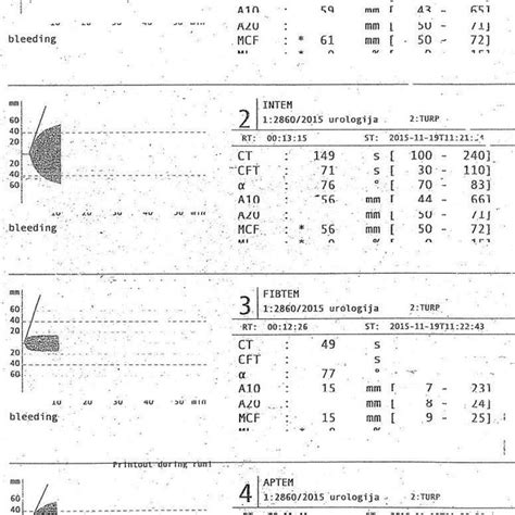 Platelet Aggregation Test Performed Immediately After The Patient Download Scientific Diagram