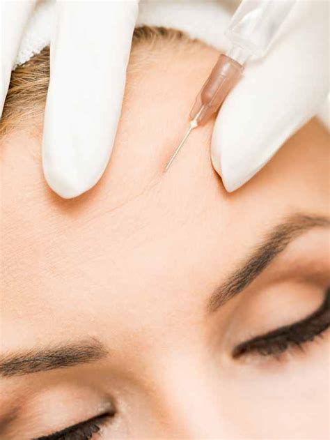 How Often To Get Botox In Forehead Injections Guide Sarah Scoop