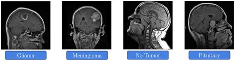 Electronics Free Full Text Classifying Brain Tumors On Magnetic Resonance Imaging By Using