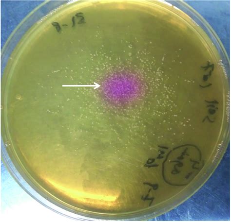 Christensens Agar Media Indicates The Ability Of Soil Bacteria To