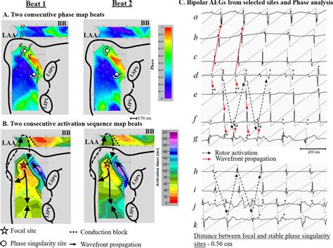 A Representative Example Patient 10 Showing Conduction Block Download Scientific Diagram