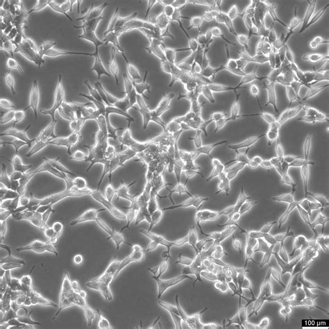 Lncap Cells