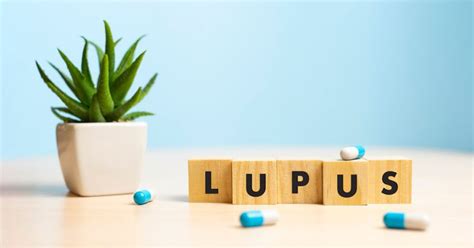 Understanding Lupus And Its Impact On The Immune System Odri Media News Breaking News East