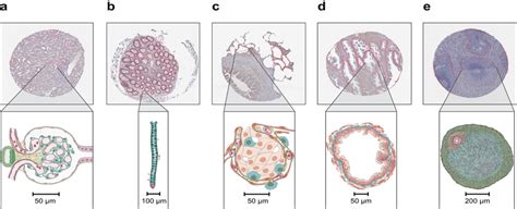 exemplary tissue microarray cores with ftu segmentations outlined in