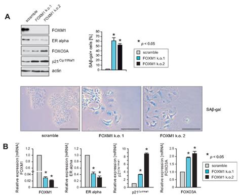 Knockdown Of Foxm1 Inhibits Expression Of Erα And Induces Cell Cycle Download Scientific