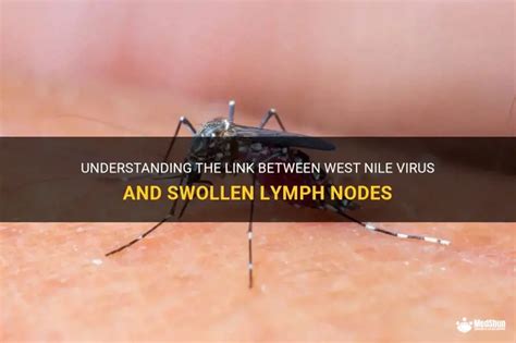 Understanding The Link Between West Nile Virus And Swollen Lymph Nodes Medshun