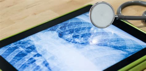 Your Electronic Health Data Understanding The Different Records