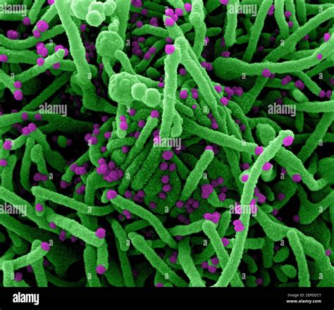 Colorized Scanning Electron Micrograph Of A Cell Green Infected With Sars Cov 2 Virus