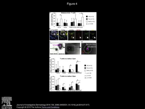 In Situ Mapping Of Innate Lymphoid Cells In Human Skin Evidence For Remarkable Differences