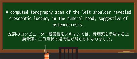 【英単語】lucencyを徹底解説！意味、使い方、例文、読み方 おもしろい英文法