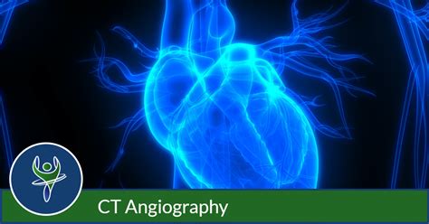 CT Angiography Capitol Imaging Services
