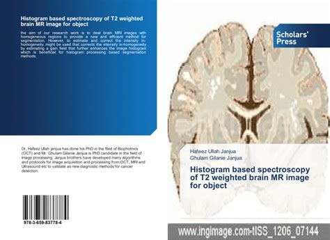 Pdf Histogram Based Spectroscopy Of T2 Weighted Brain Mr Image For Object