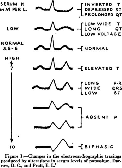 Figure 1 From The Importance Of Potassium After Operation Semantic Scholar