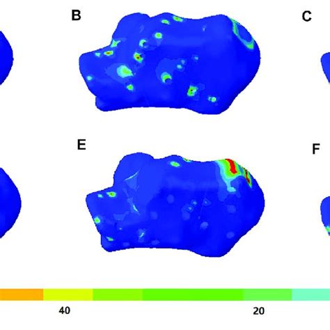 boundary and loading conditions of the finite element fe model at