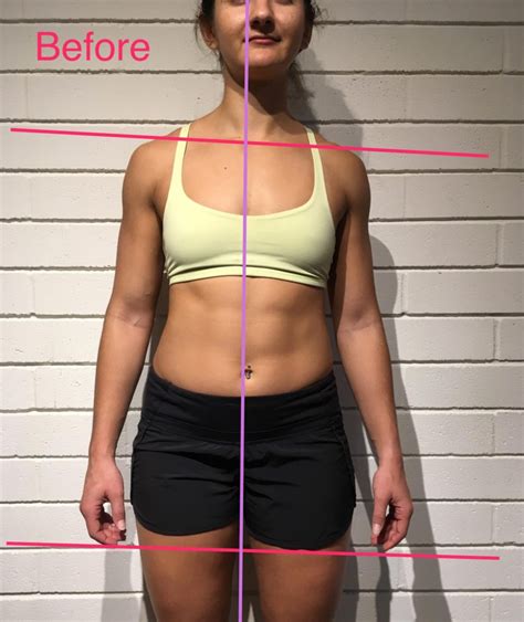 What Is Structural Integration Hands On Wellness