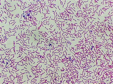 大肠杆菌，又称大肠杆菌，是一种革兰氏阴性，兼性厌氧，杆状细菌显微镜。