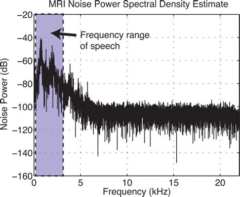 Color Online MRI Noise Power Lies In The Frequency Range Of Speech Download Scientific