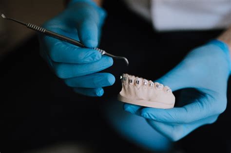 Incisor Classification Why Its Important Badov Orthodontics