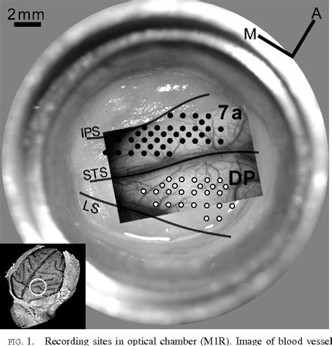 Figure 3 From Neural Representation During Visually Guided Reaching In Macaque Posterior